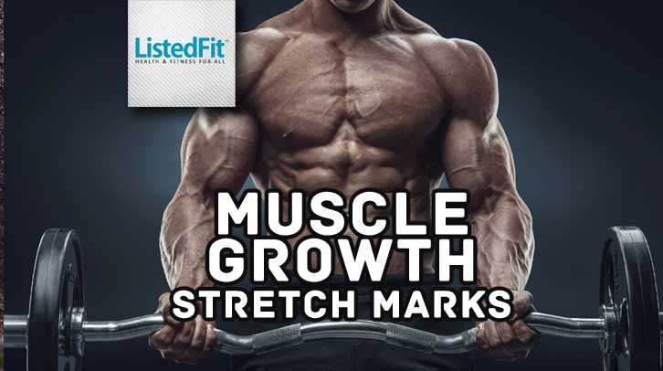 Stretch Marks From Muscle Growth - All You Need to Know